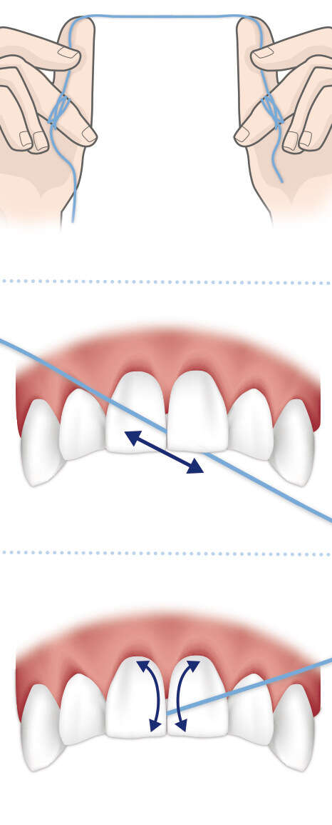 Zahnseide anwenden | Denta Expert